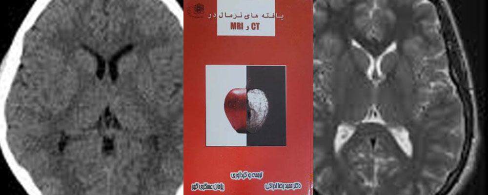 Normal Findings in MRI and CT - Rare Diseases Foundation of IRAN