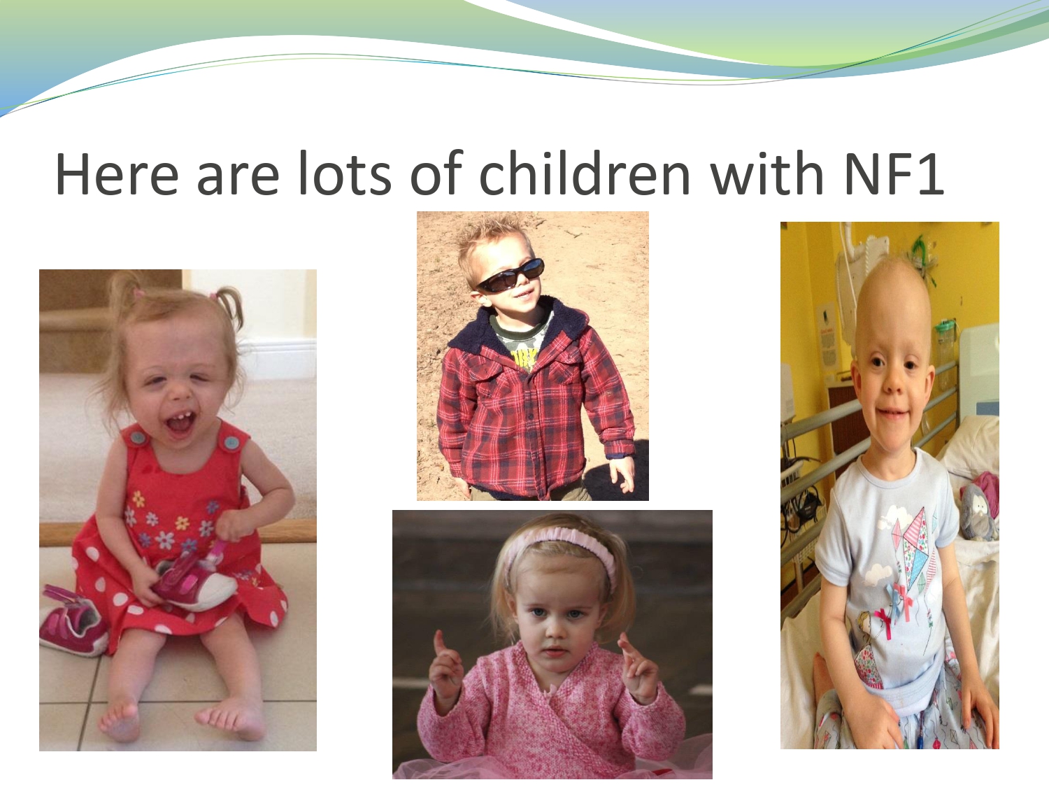 What is Neurofibromatosis type 1 (NF1)? - Rare Diseases Foundation of IRAN